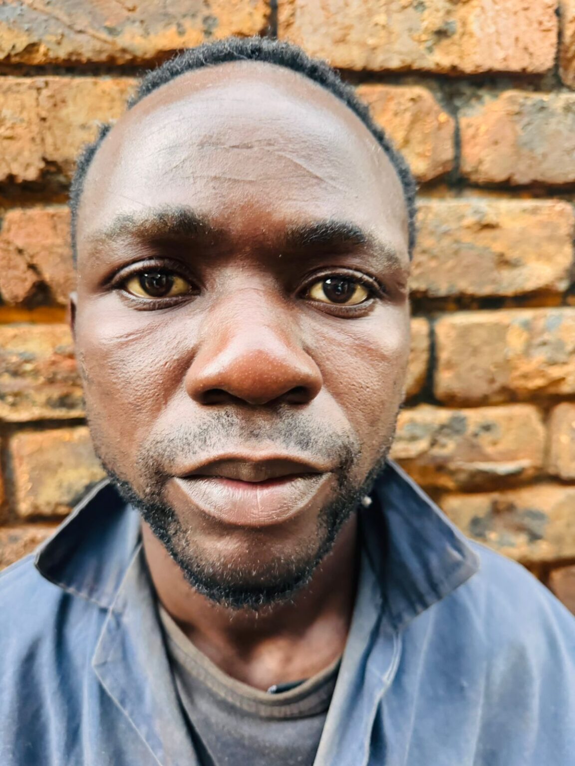 MANHUNT LAUNCHED FOR AN AWAITING TRIAL PRISONER WHO ESCAPED FROM LAWFUL ...